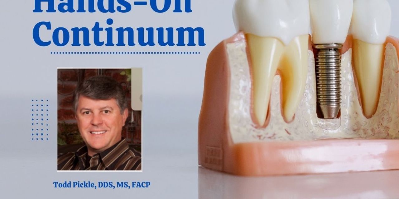 A-Z Implants for the General Dentist : Dental Implants Hands-On ...